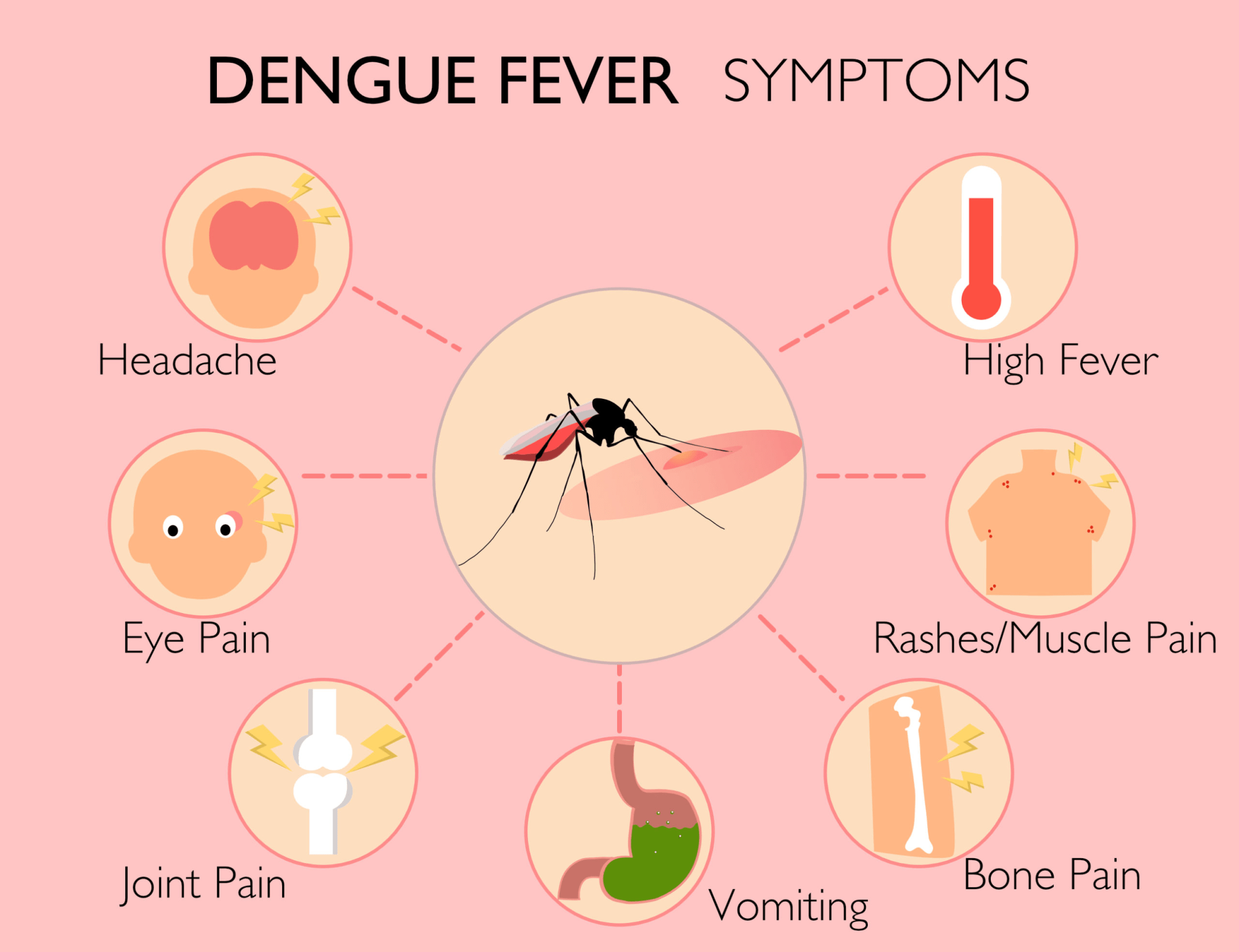 Dengue: Symptoms, Causes, and Prevention – daneelyunus