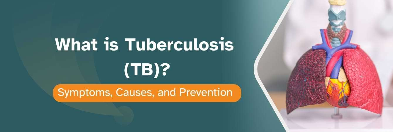 Tuberculosis, Symptoms and Stages, Causes, Risk Factors, and Prevention ...
